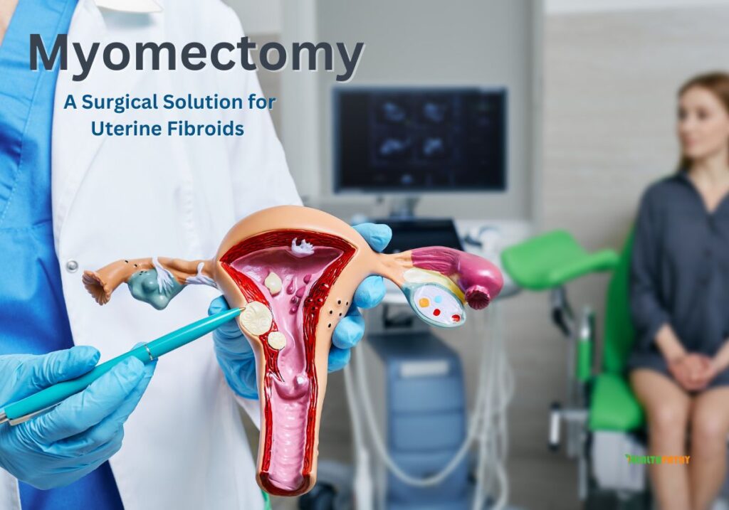 Myomectomy A Surgical Solution For Uterine Fibroids Myomectomy A Surgical Solution For Uterine Fibroids