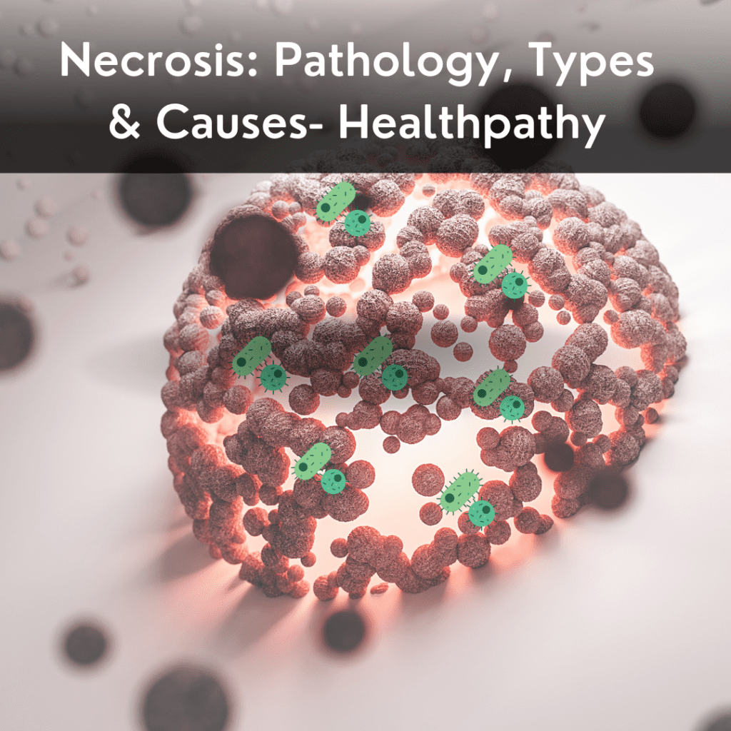 Necrosis: Pathology, Types & Causes- Healthpathy