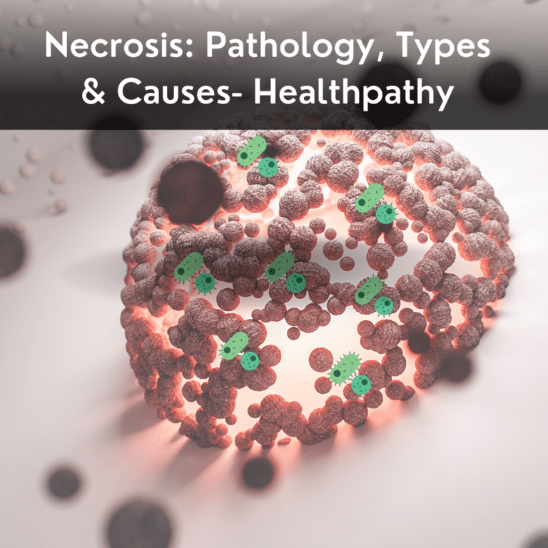 Necrosis: Pathology, Types & Causes- Healthpathy