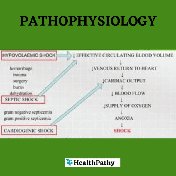 SHOCK- Types, Etiology and Pathophysiology