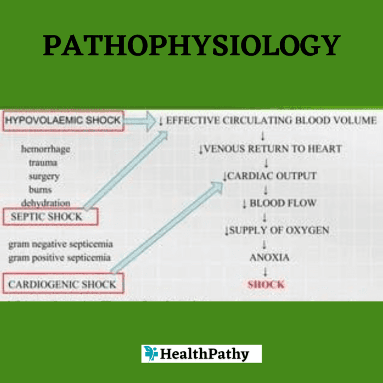 SHOCK- Types, Etiology and Pathophysiology